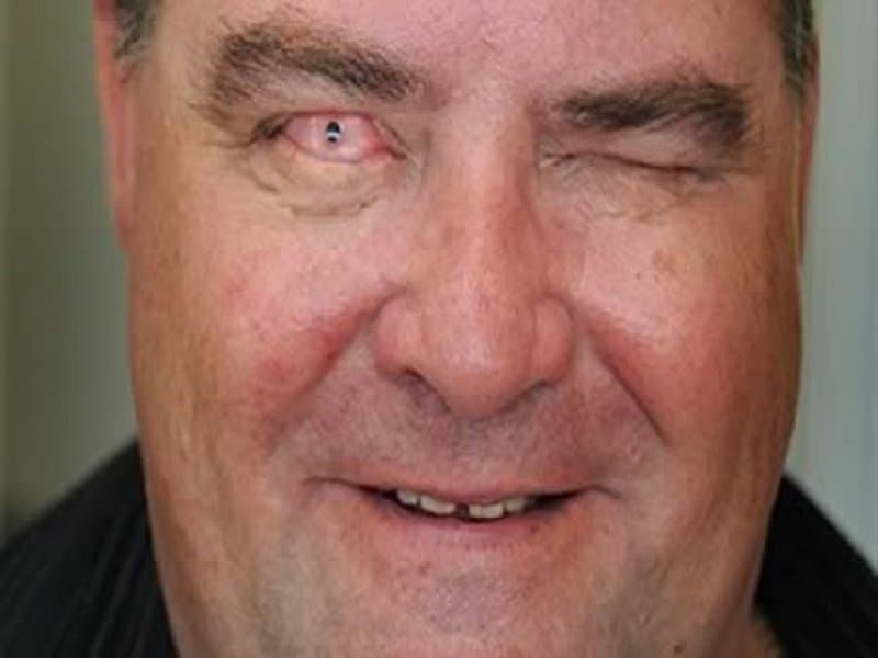 10 Of The Most Bizarre Eyes In The World - Page 4 of 5